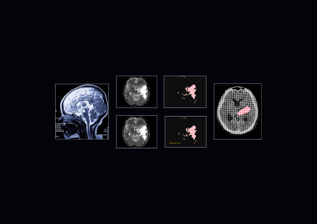 Medical & Healthcare Data Annotation Services in India | Pixel Annotation